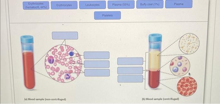 Solved (a) Blood sample (non-centrifuged) (b) biood sample | Chegg.com
