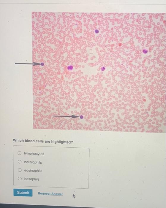 solved-which-blood-cells-are-highlighted-lymphocytes-chegg