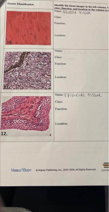 Tissues Identification Identify the tiswee limages in | Chegg.com