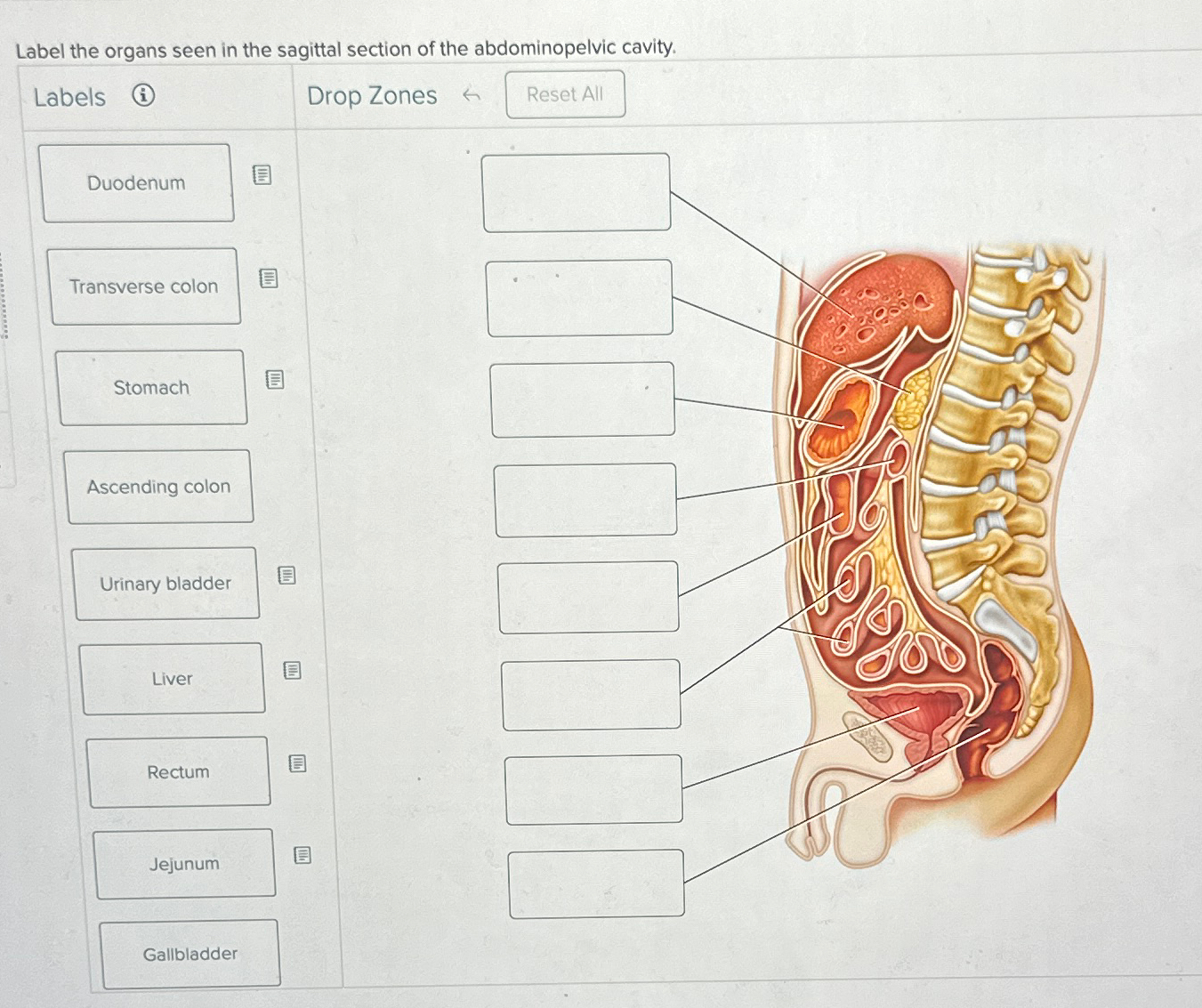 Solved Label the organs seen in the sagittal section of the | Chegg.com