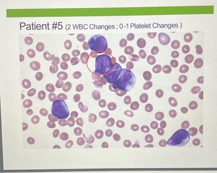 Solved Patient \#5 (2 WBC Changes; 0-1 Platelet Changes | Chegg.com