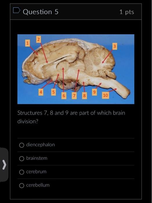 Solved Structures 7,8 and 9 are part of which brain | Chegg.com