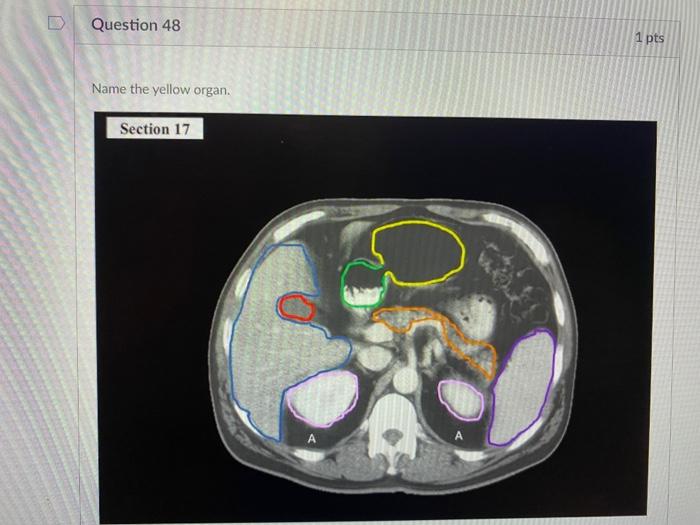 Solved The blue tube is the All three colored organs are | Chegg.com