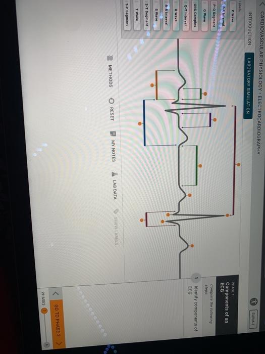 Solved CARDIOVASCULAR PHYSIOLOGY ELECTROCARDIOGRAPHY SUBMIT | Chegg.com