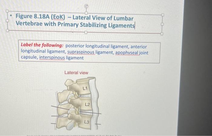 Solved - Figure 8.18A (EoK) - Lateral View of Lumbar | Chegg.com