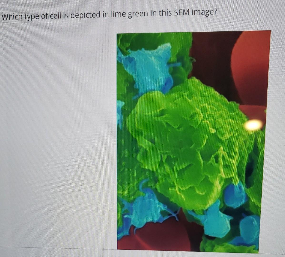 Solved Which type of cell is depicted in lime green in this | Chegg.com