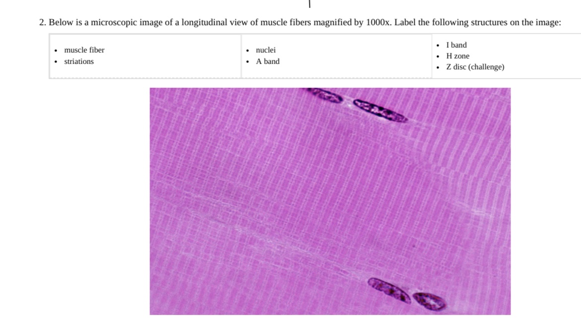 Solved Below is a microscopic image of a longitudinal view | Chegg.com