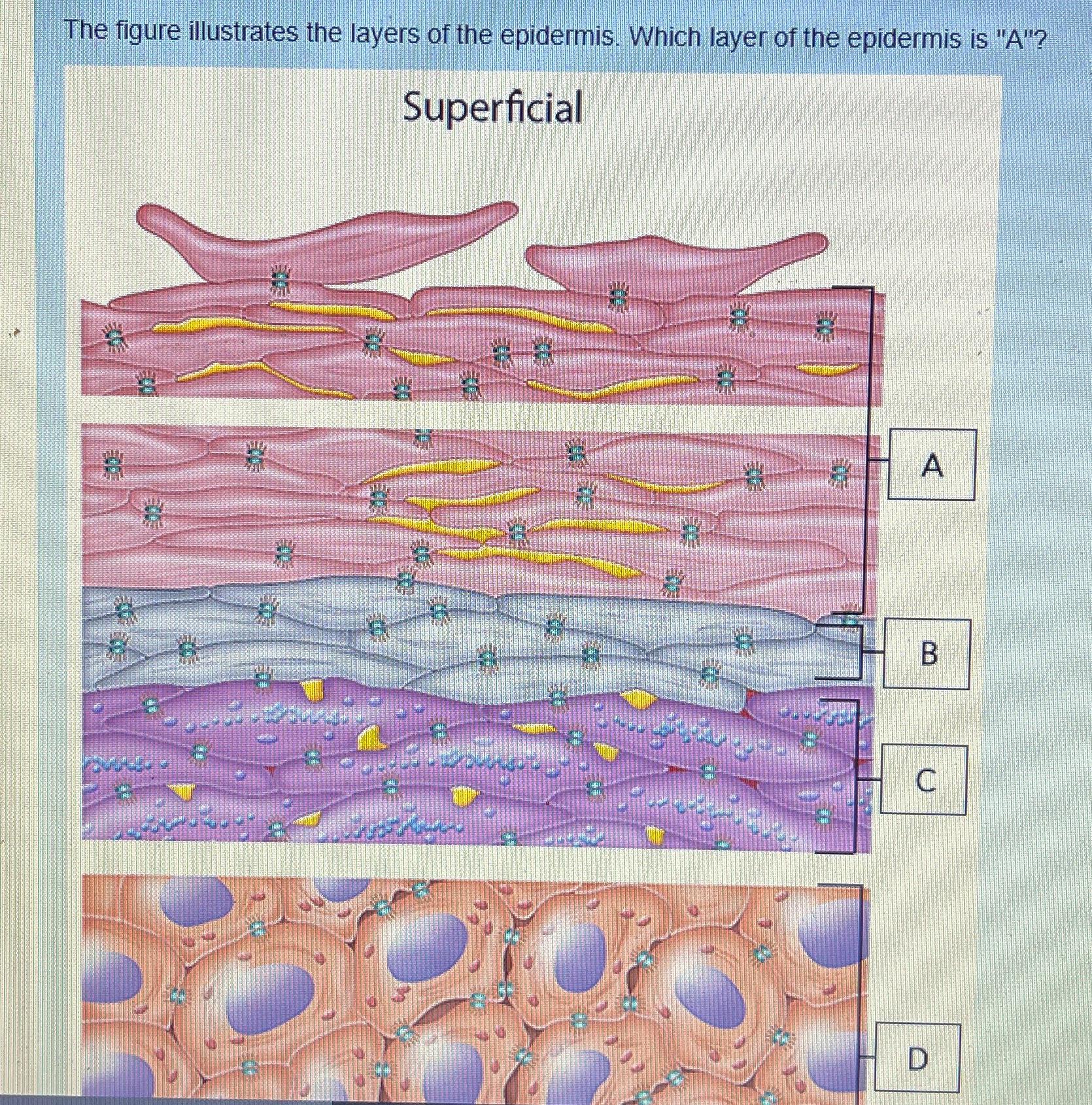 Solved The figure illustrates the layers of the epidermis. | Chegg.com