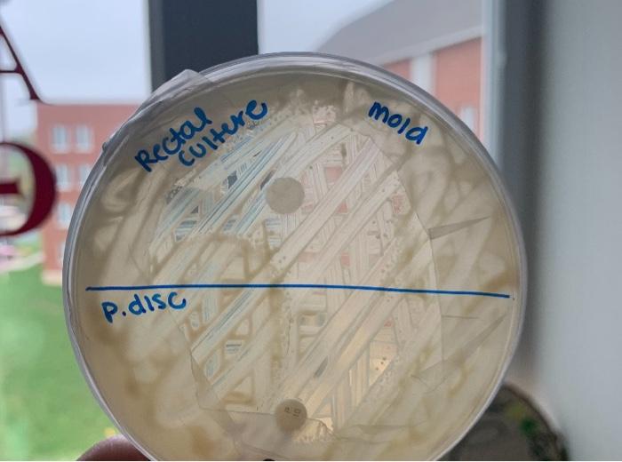 Examine your TSA plates with the antibiotic and mold | Chegg.com