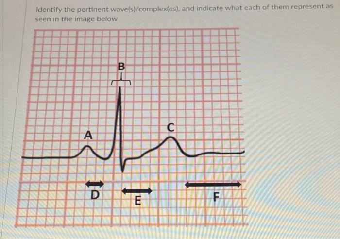 Solved Identify the pertinent wave(s)/complex(es), and | Chegg.com