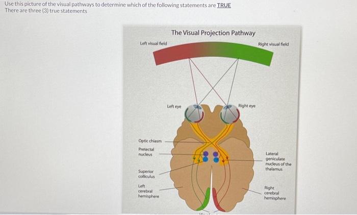 Solved Use this picture of the visual pathways to determine | Chegg.com