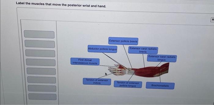 Solved Label the muscles that move the anterior wrist and | Chegg.com
