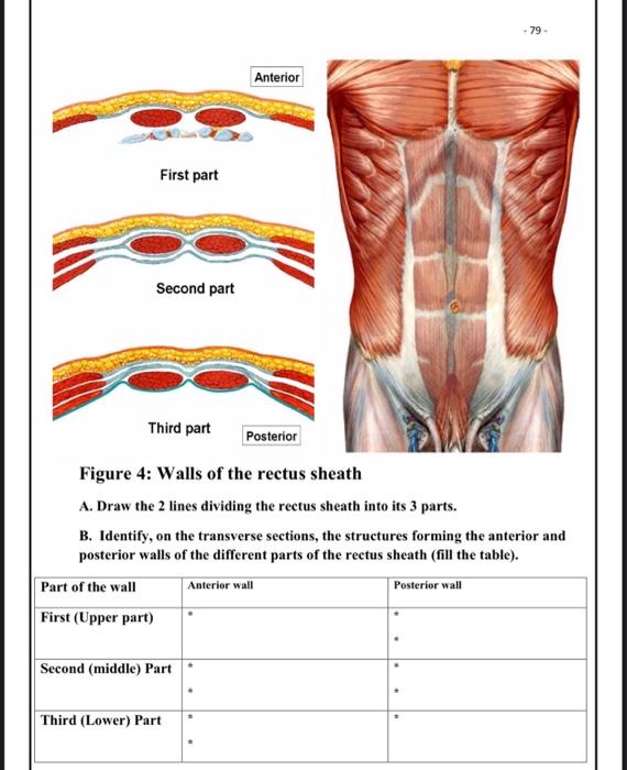 Solved Figure 4: Walls of the rectus sheath A. Draw the 2 | Chegg.com