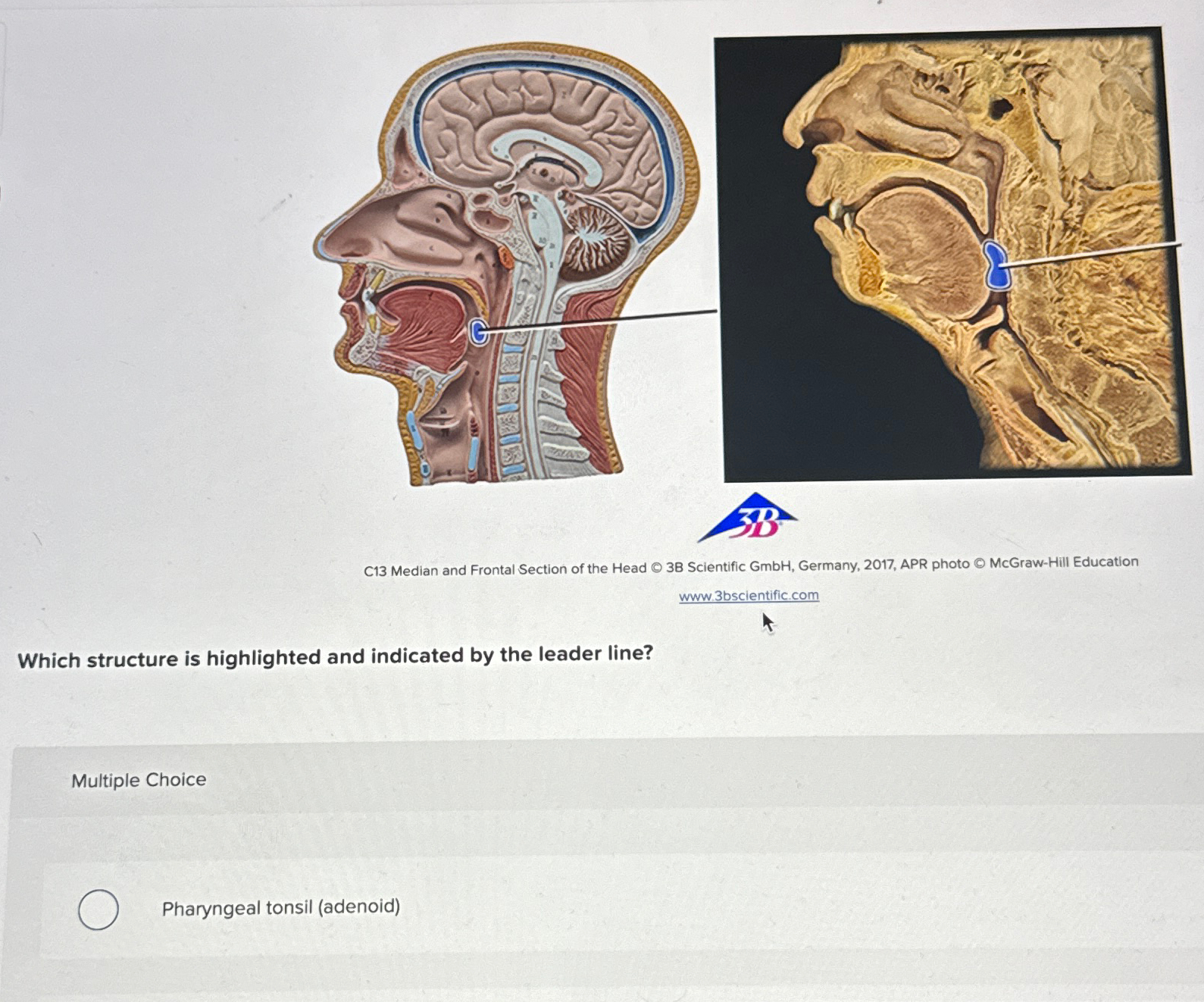 Solved C13 ﻿Median and Frontal Section of the Head (1) 38 | Chegg.com