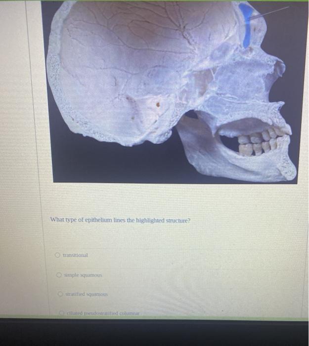 Solved What type of epithelium lines the highlighted | Chegg.com
