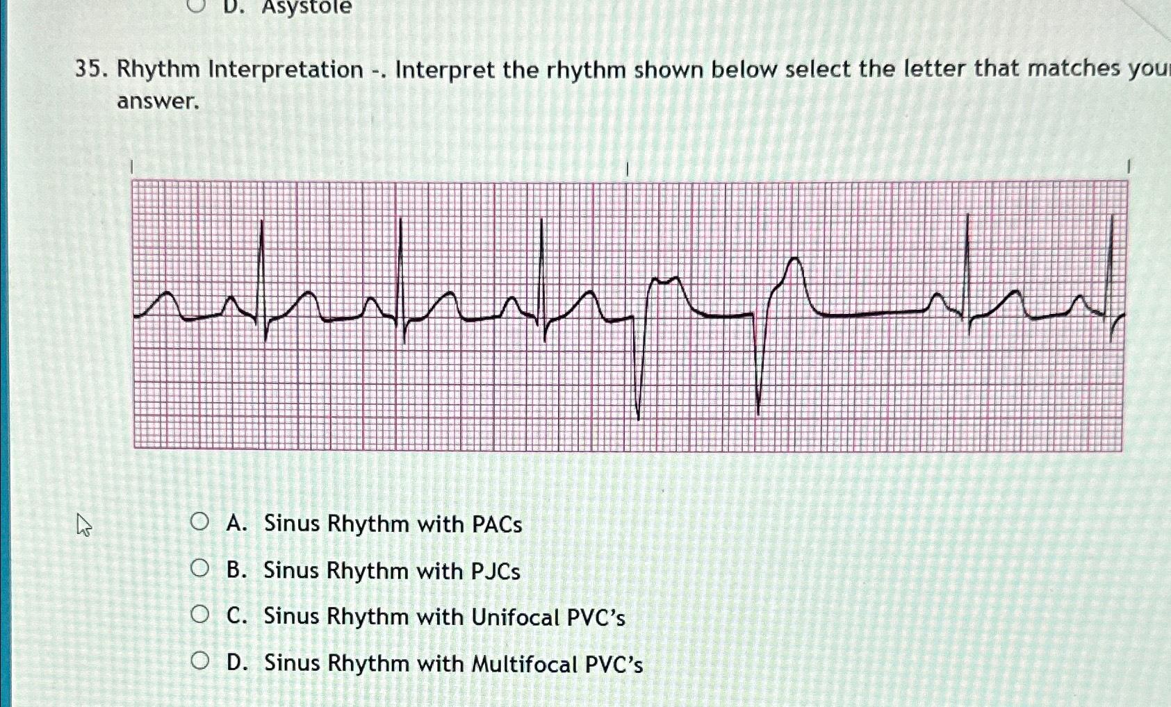 Solved Rhythm Interpretation -. ﻿Interpret the rhythm shown | Chegg.com