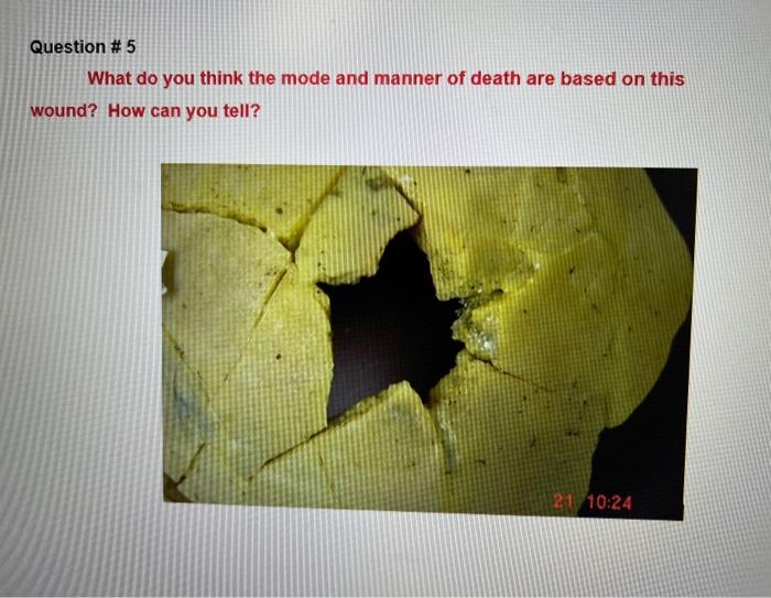 Solved What do you think the mode and manner of death are | Chegg.com
