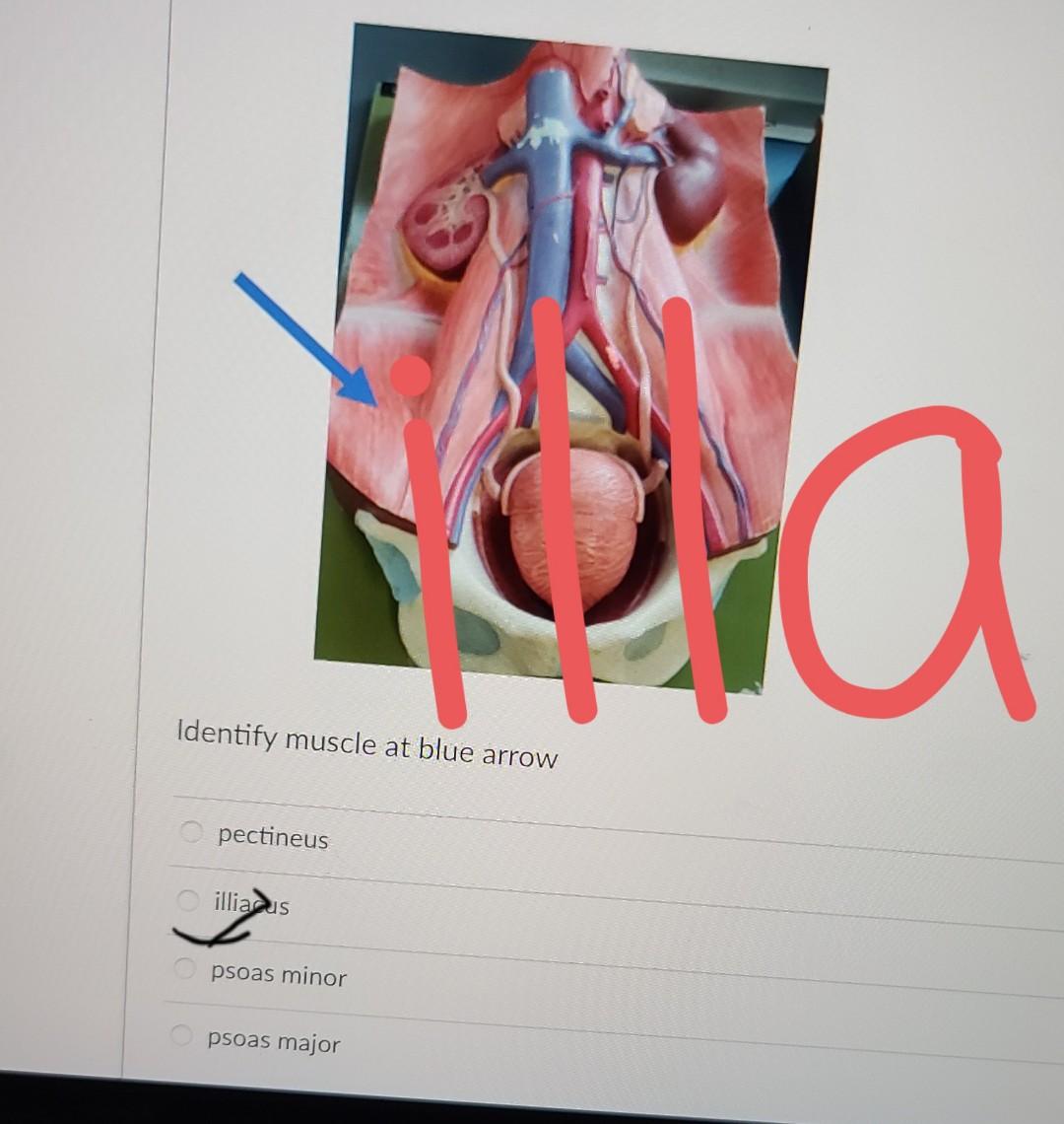 Solved endoneurium epineurium myelin perineurium Previous | Chegg.com