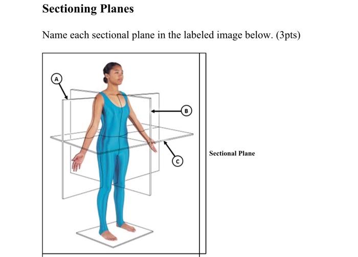 Solved Sectioning Planes Name each sectional plane in the | Chegg.com