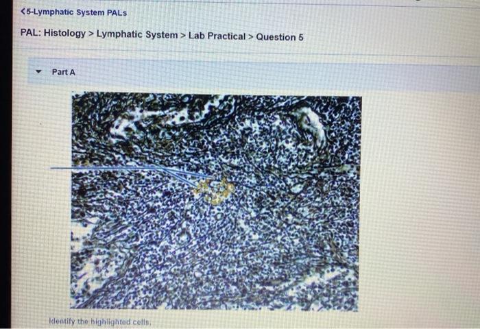 Solved Lymphatic | Chegg.com