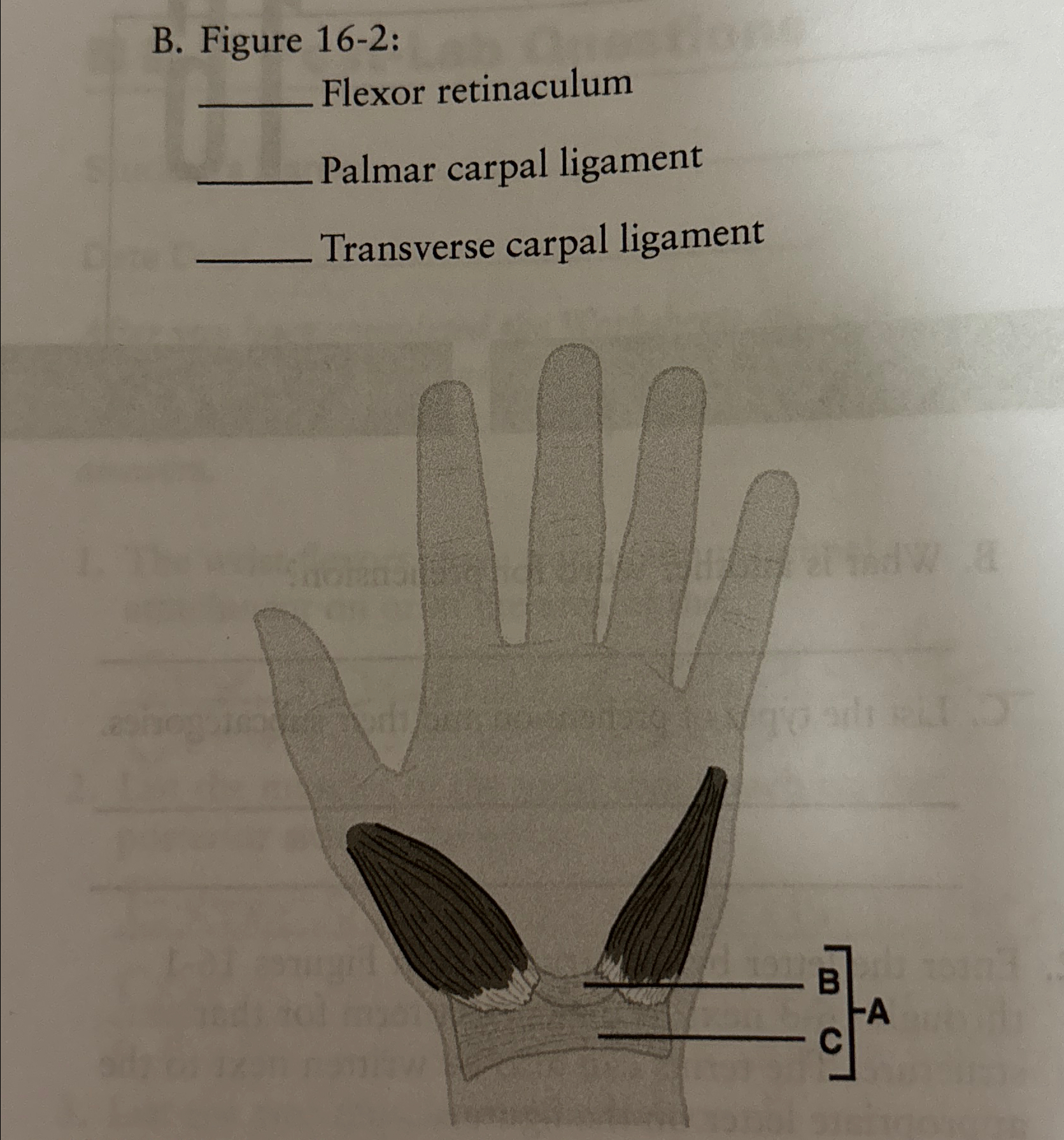 Solved B. ﻿Figure 16-2:Flexor retinaculumPalmar carpal | Chegg.com