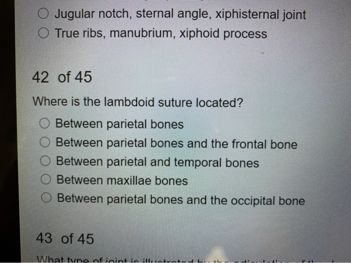 Solved Jugular notch, sternal angle, xiphisternal joint True | Chegg.com