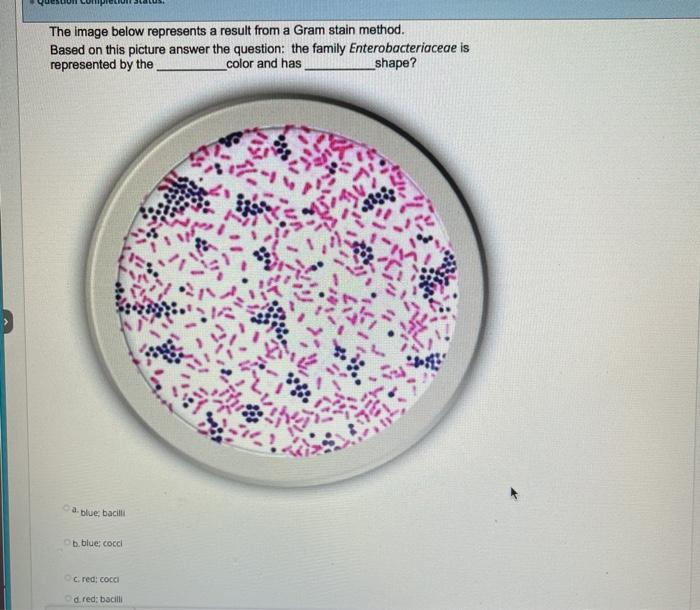 Solved The image below represents a result from a Gram stain | Chegg.com