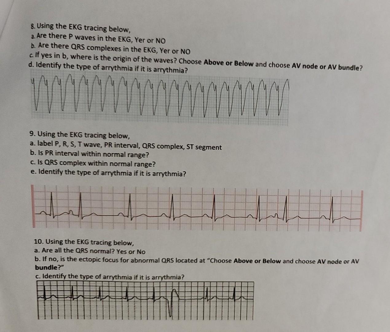 8. Using the EKG tracing below, a. Are there P waves | Chegg.com