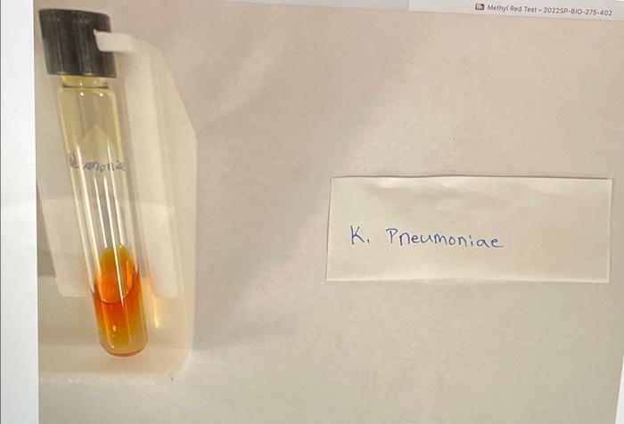 Solved PART B: Methyl Red Test and Voges-Proskauer Test | Chegg.com