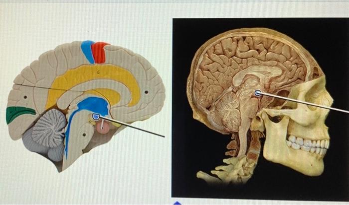 Solved Which structure is highlighted and indicated by | Chegg.com