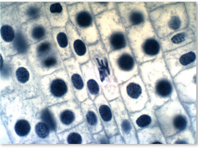 Solved Examine the onion root tip slide images on the | Chegg.com