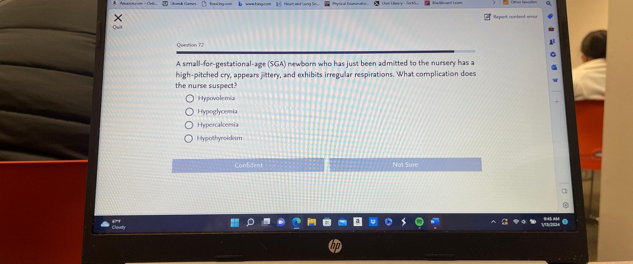 Solved Question 72A small-for-gestational-age (SGA) ﻿newborn | Chegg.com