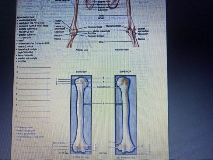 Solved BO H Boby (h The Rad Cleonon los Coronel Medus | Chegg.com