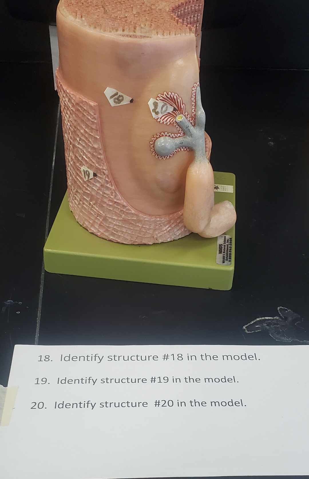 [solved] Identify Structure 18 In The Model Identify Stru
