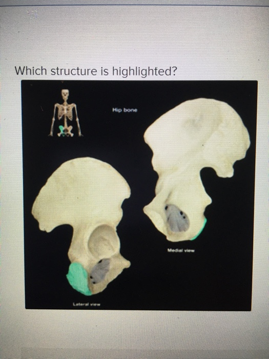 Solved Which structure is highlighted? Hip bone का & | Chegg.com