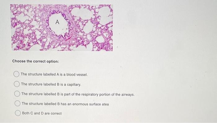 Solved Below is a Spirograph from a patient who has | Chegg.com