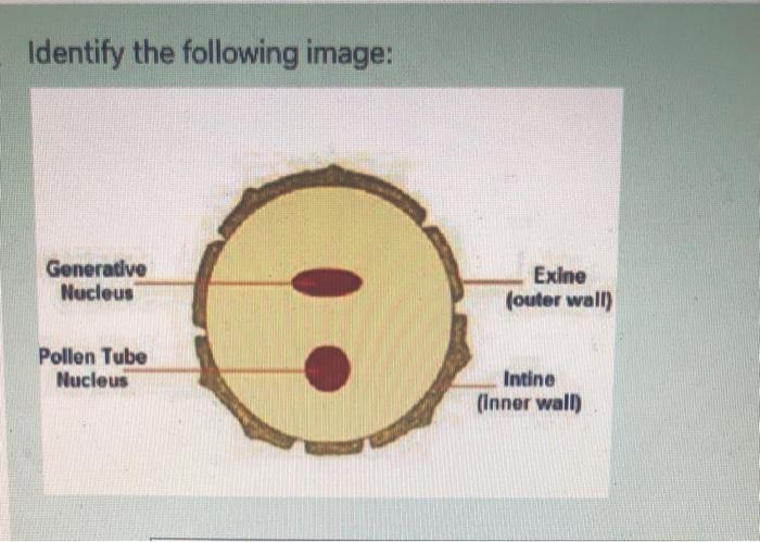 Solved Identify the following image: Generative Nucleus | Chegg.com