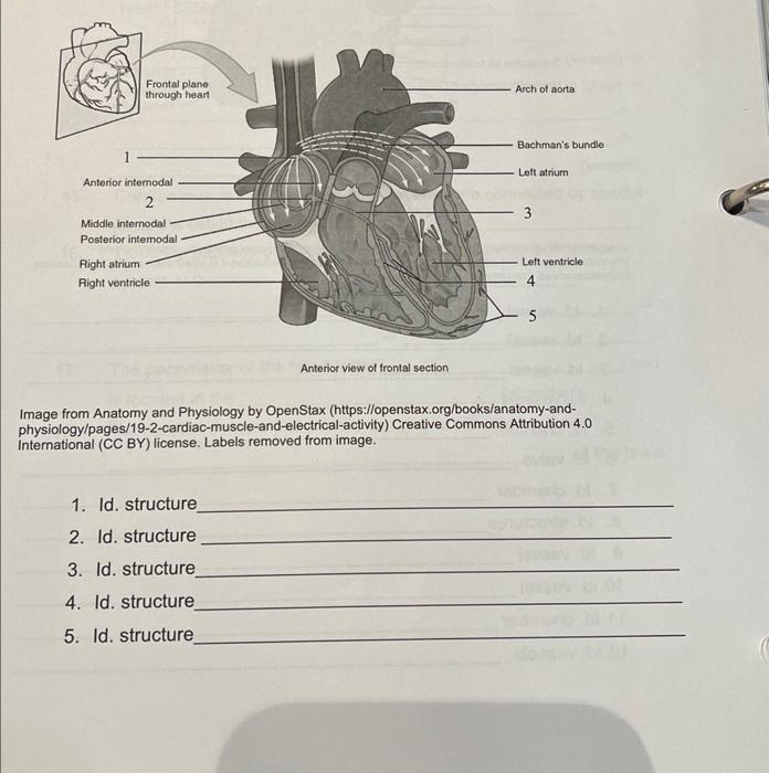 Solved Anterior view of frontal section mage from Anatomy | Chegg.com