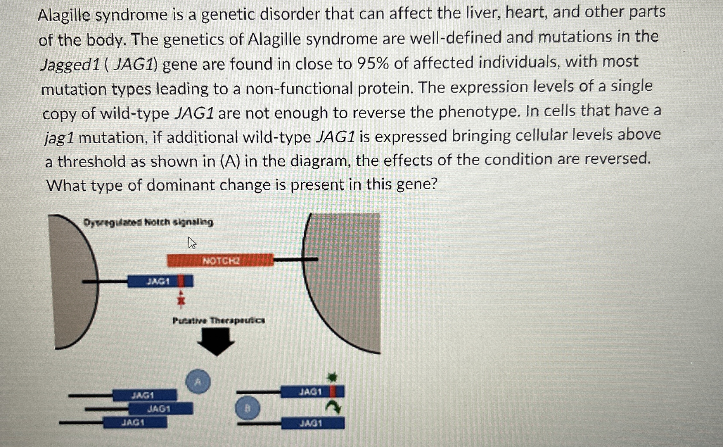Solved Alagille syndrome is a genetic disorder that can | Chegg.com