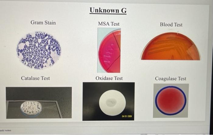 Solved Unknown G Gram Stain MSA Test Blood Test Catalase | Chegg.com