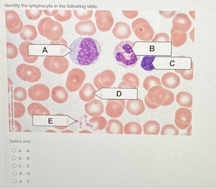Solved Identify the lymphocyte in the following slide: O | Chegg.com