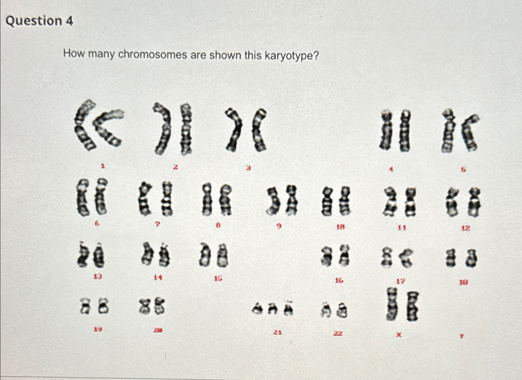 How many chromosmes are shown this karyotype? | Chegg.com