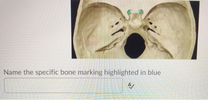 Solved Name the specific structures highlighted in blue AJ | Chegg.com