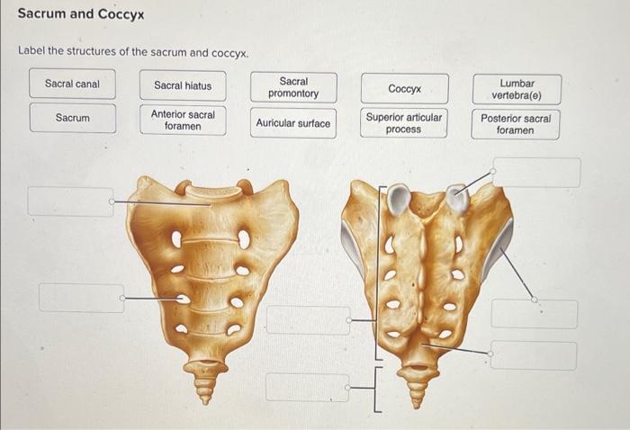 Solved Sacrum and Coccyx Label the structures of the sacrum | Chegg.com