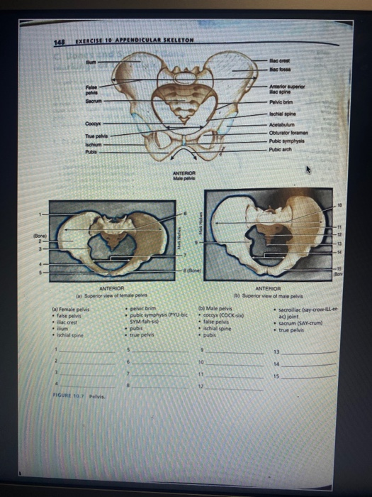 Solved 144 EXERCISE 10 APPENDICULAR SKELETON 3. The Oo noch | Chegg.com