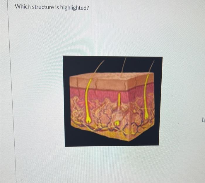 Solved Which structure is highlighted? sebaceous gland | Chegg.com