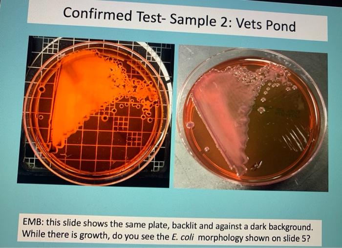 2. Observe the EMB plates for colonies that have the | Chegg.com
