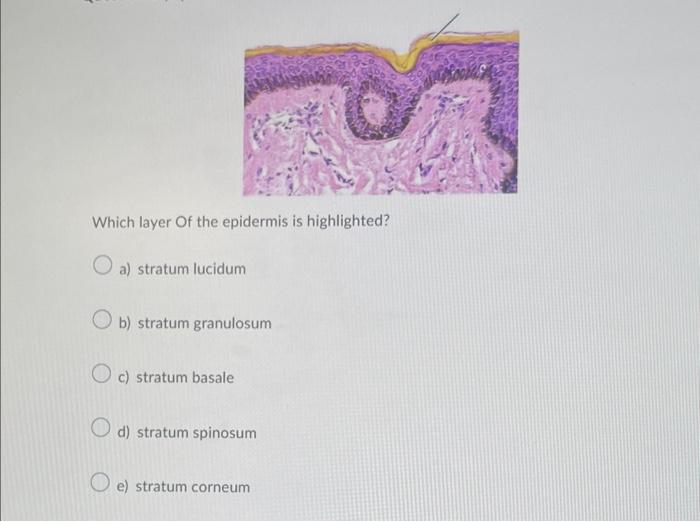 Solved Which layer is bighlighted? a) stratum basale b) | Chegg.com