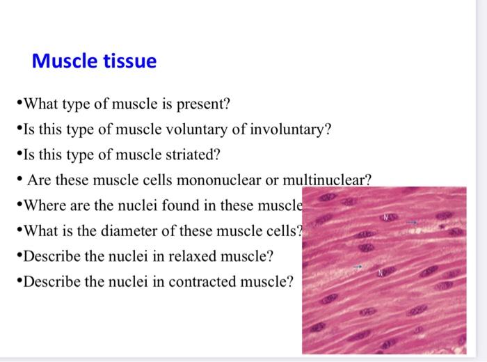 Solved Muscle tissue -What type of muscle is present? -Is | Chegg.com