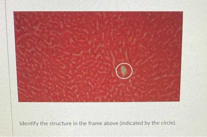 Solved 0) Identify the structure in the frame above | Chegg.com
